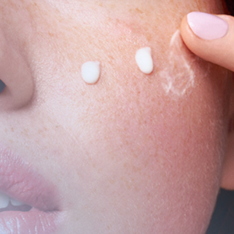 Astra Skin Facial Treatments: for every skin type | Tagged "COLLECTION ...